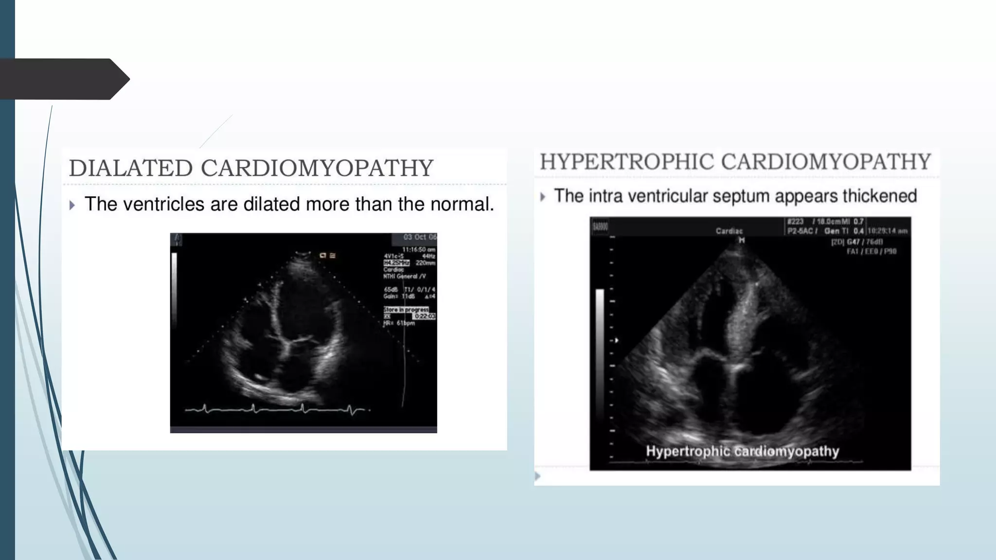 ECHO WINDOWS AND VIEWS.pptx