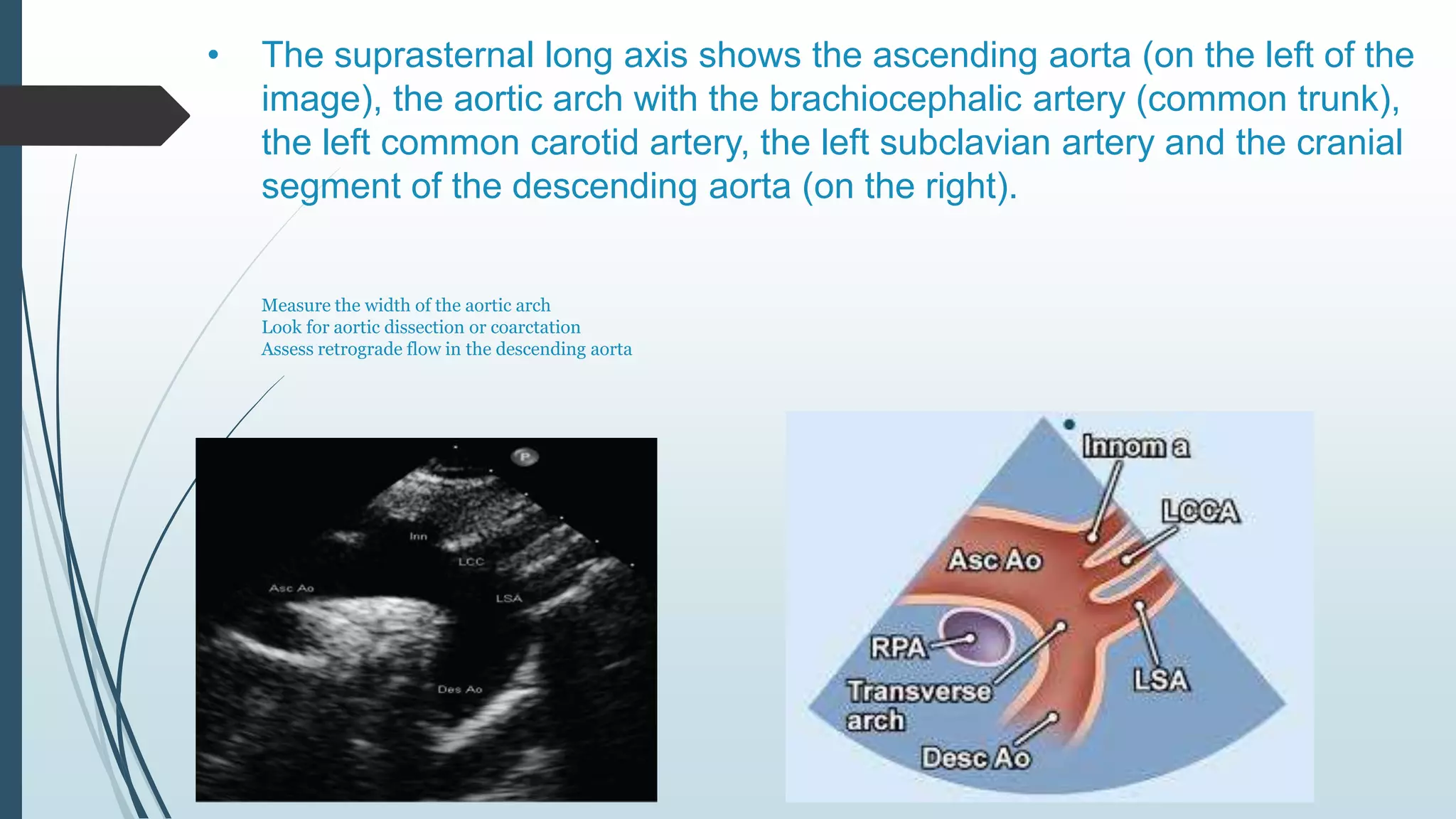 ECHO WINDOWS AND VIEWS.pptx