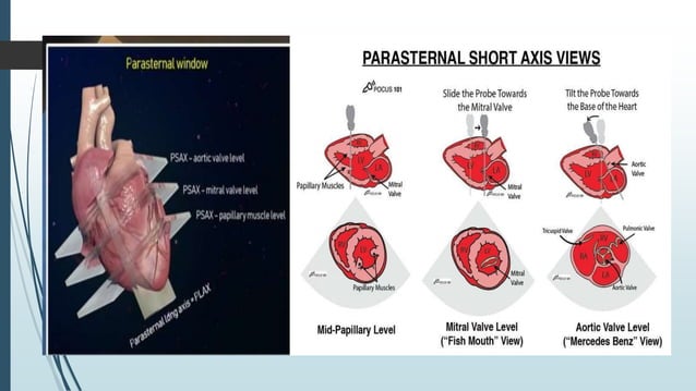 ECHO WINDOWS AND VIEWS.pptx | Digital Audio | Computer Software and ...