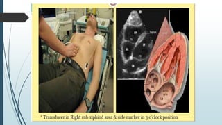 ECHO WINDOWS AND VIEWS.pptx