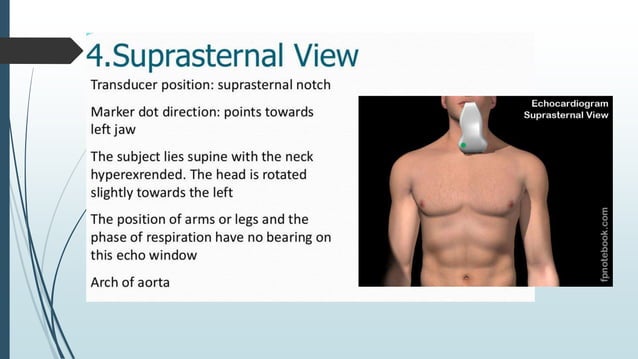 ECHO WINDOWS AND VIEWS.pptx | Digital Audio | Computer Software and ...