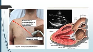 ECHO WINDOWS AND VIEWS.pptx