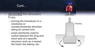 Echo ppt1 Akhtar Totakhail.pptx