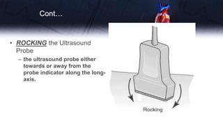 Echo ppt1 Akhtar Totakhail.pptx