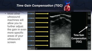 Echo ppt2 Akhtar Totakhail.pptx