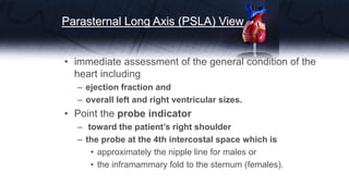 Echo ppt3 Akhtar Totakhail.pptx