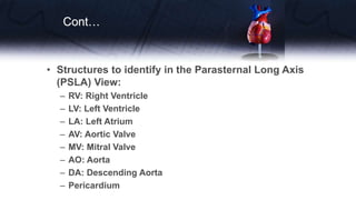 Echo ppt3 Akhtar Totakhail.pptx