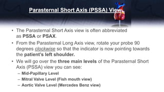 Echo ppt3 Akhtar Totakhail.pptx