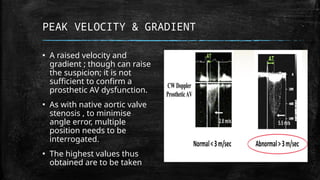 ECHO IN THE ASSESSMENT OF PROSTHETIC HEART VALVE.pptx