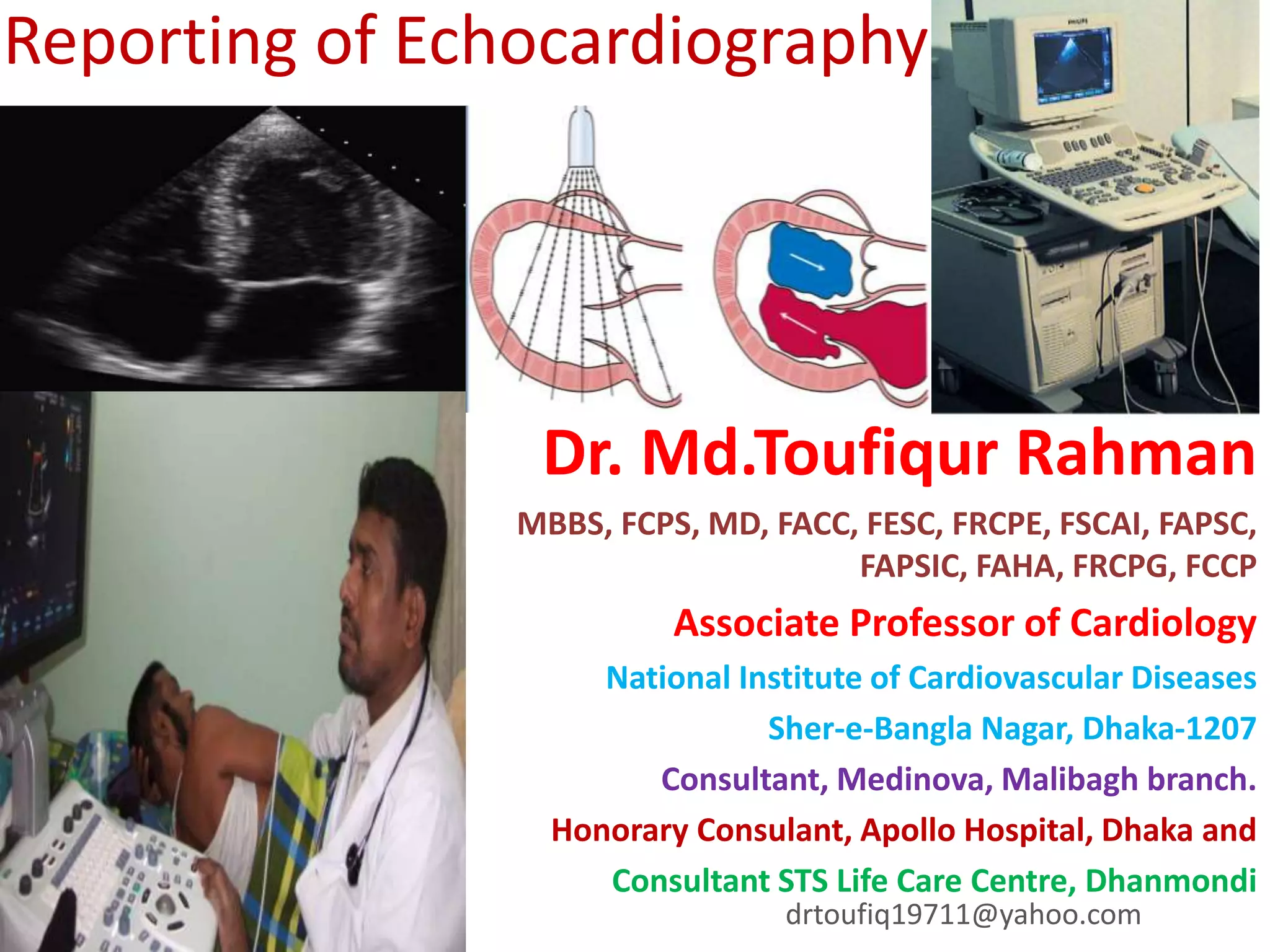 Echo reporting basics | PPSX