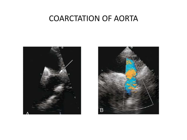 ECHO SEGMENTAL APPROACH- DR BINJO.ppsx
