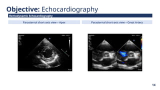 Echocardiography NH copy RWMA new ll.pptx