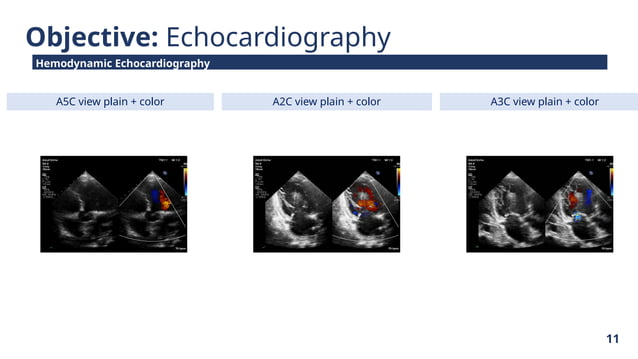 Echocardiography NH copy RWMA new ll.pptx