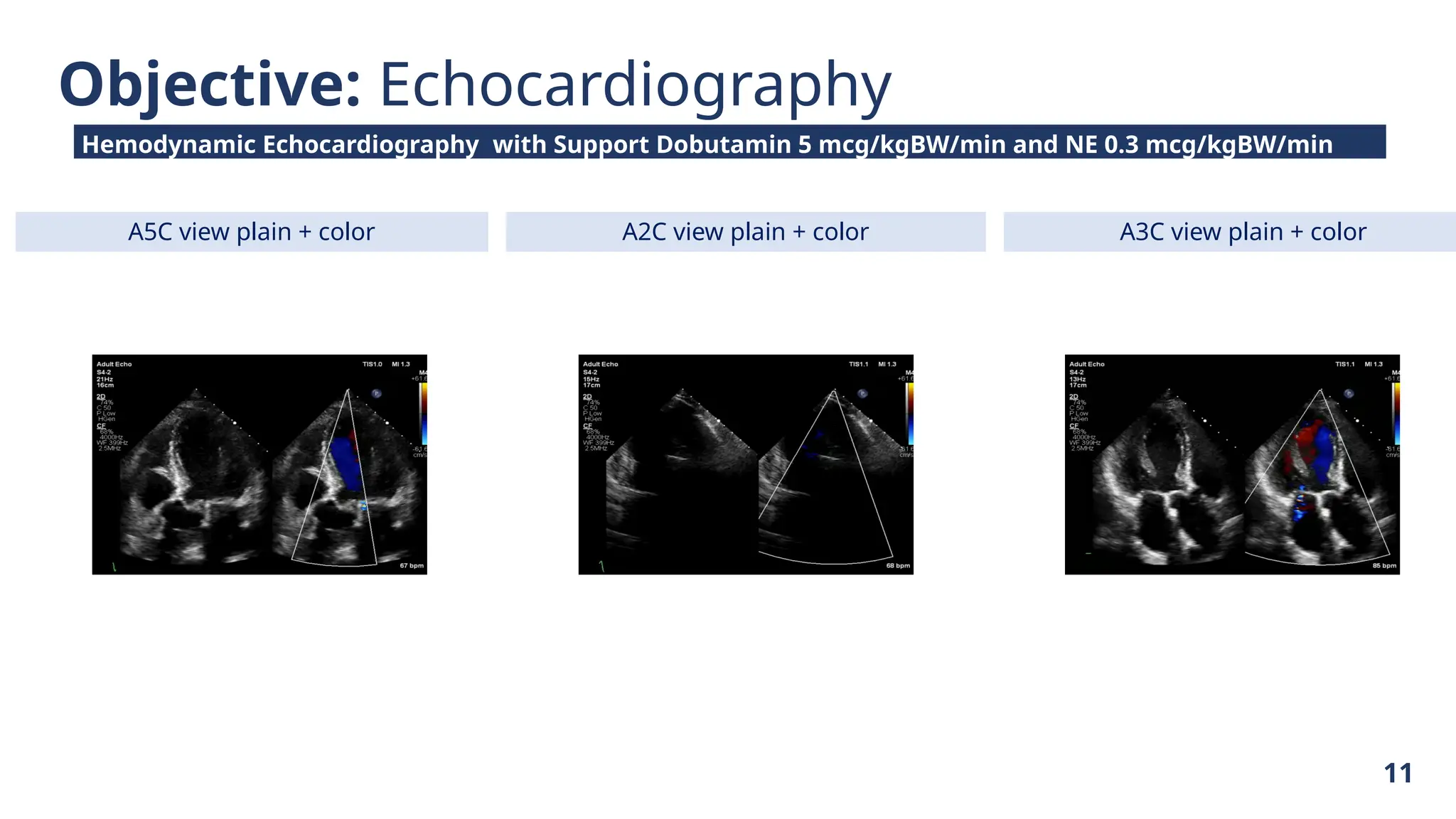 Echocardiography SP heart failure new.pptx