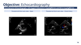 Echocardiography SP heart failure new.pptx