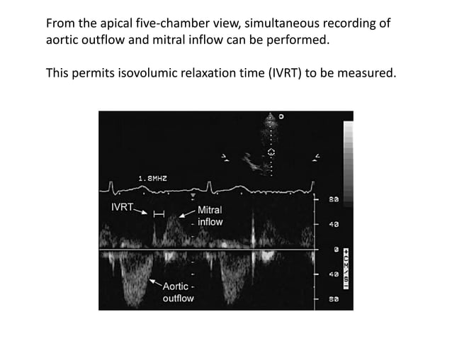 Echo views | PPTX | Heart and Cardiovascular Diseases | Diseases and ...