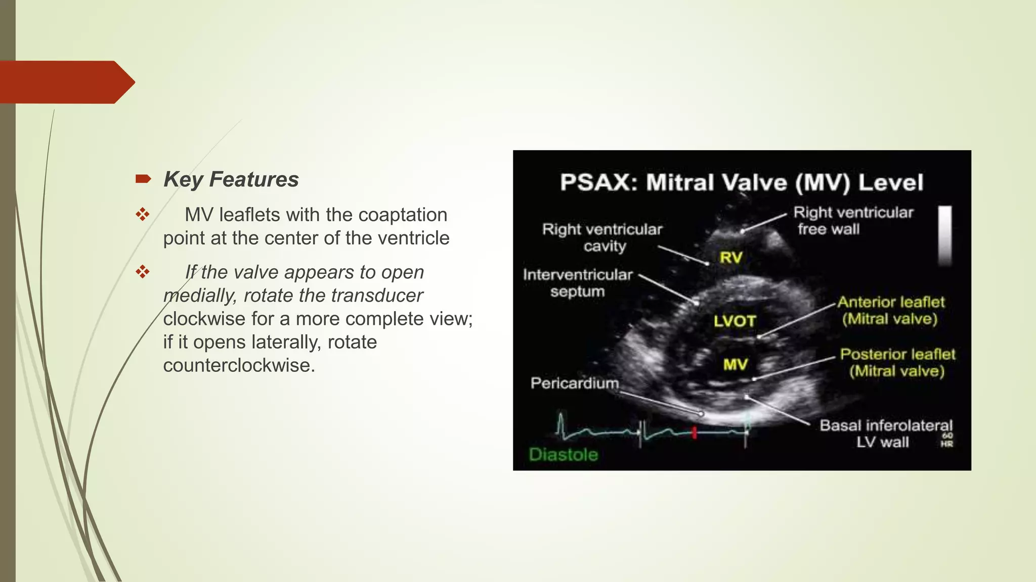 ECHO views and measurements-Dr. Razu.pptx
