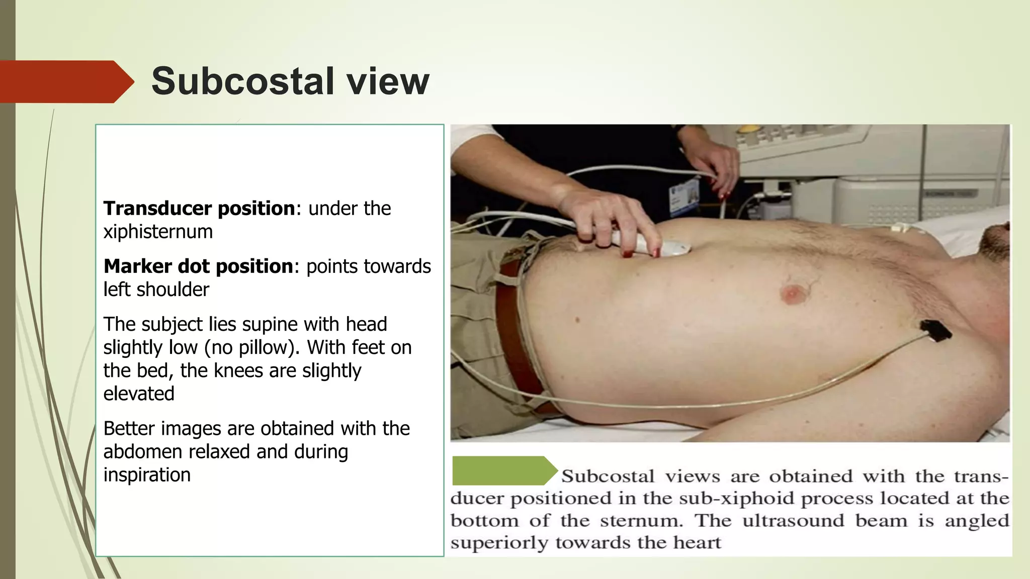 ECHO views and measurements-Dr. Razu.pptx