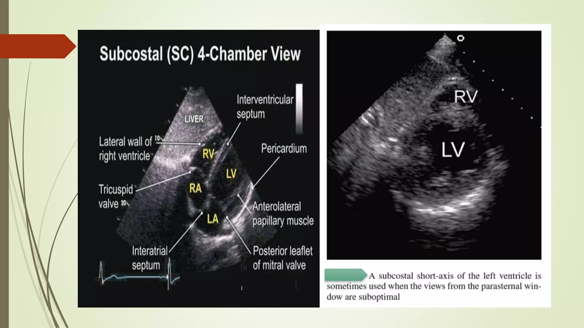 ECHO views and measurements-Dr. Razu.pptx