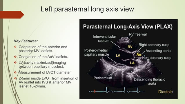 ECHO views and measurements-Dr. Razu.pptx