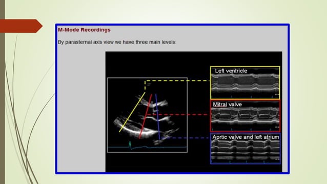 ECHO views and measurements-Dr. Razu.pptx