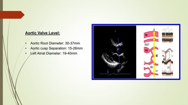 ECHO views and measurements-Dr. Razu.pptx