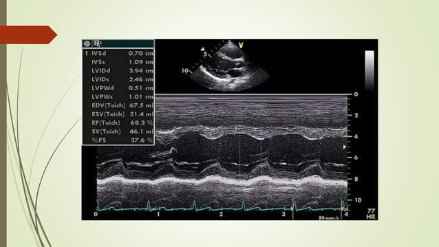 ECHO views and measurements-Dr. Razu.pptx