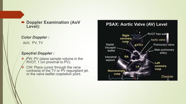 ECHO views and measurements-Dr. Razu.pptx