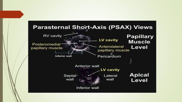 ECHO views and measurements-Dr. Razu.pptx