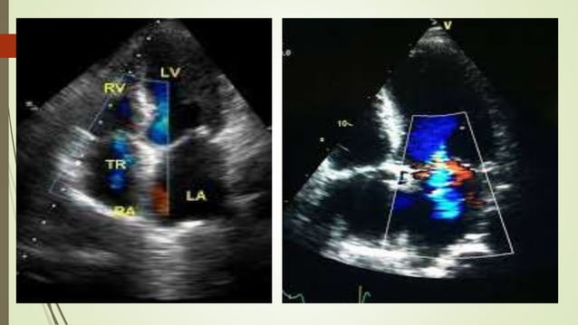 ECHO views and measurements-Dr. Razu.pptx