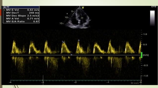 ECHO views and measurements-Dr. Razu.pptx