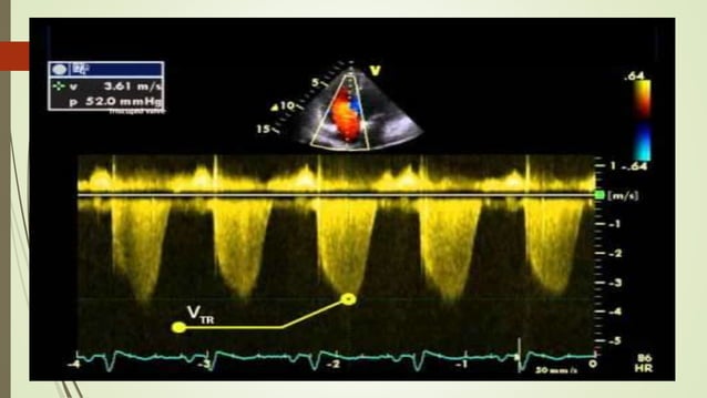 ECHO views and measurements-Dr. Razu.pptx