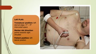 ECHO views and measurements-Dr. Razu.pptx