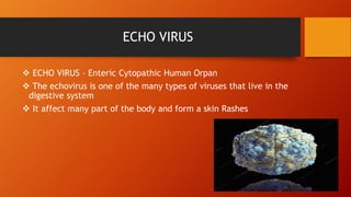 ECHO VIRUS VIROLOGY .pptx