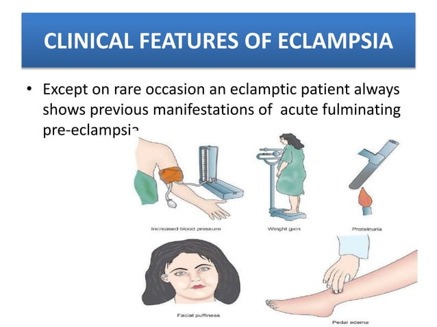 Eclampsia | PPTX | Pregnancy | Reproductive Health