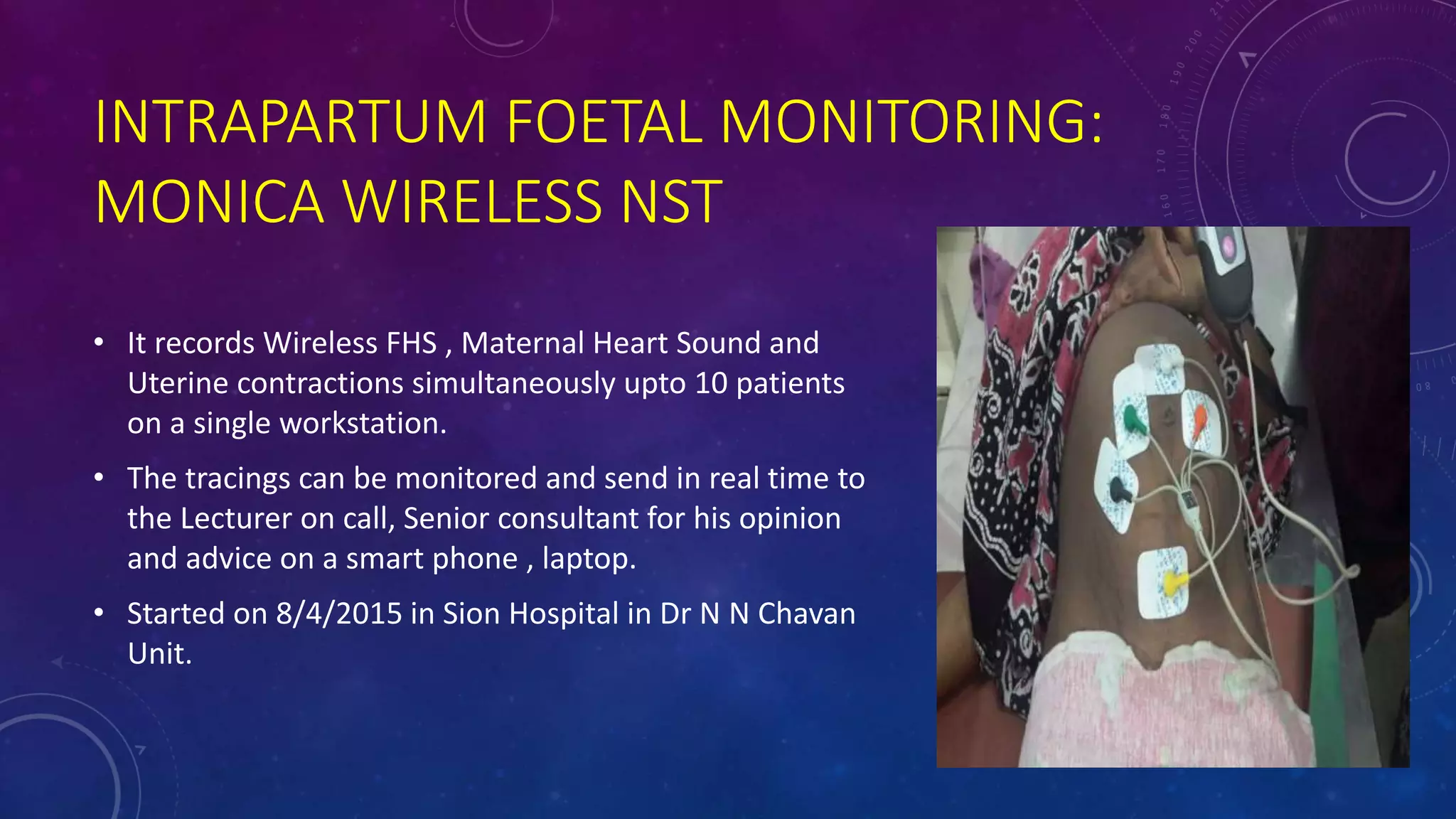 Eclampsia and Maternal Transport | PPTX