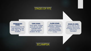Eclampsia | PPTX