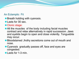 Eclampsia | PPTX