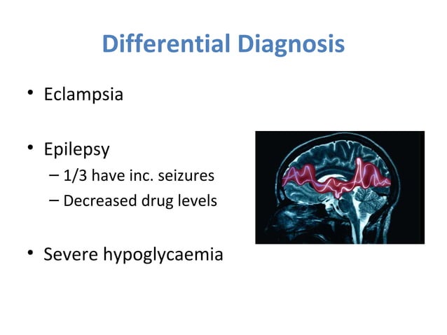 Eclampsia case study | PPT
