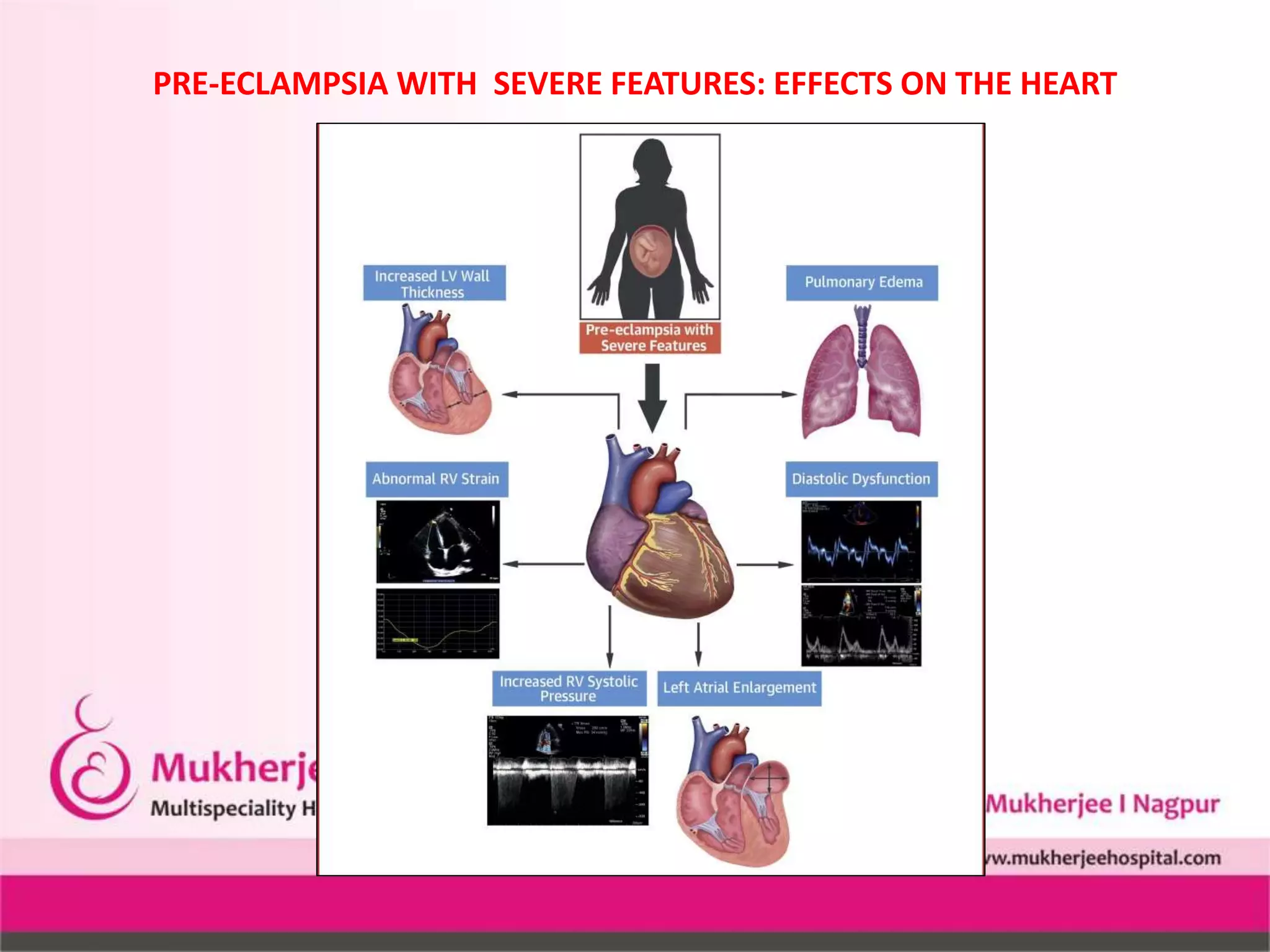Eclampsia labor room protocol by dr alka mukherjee dr apurva mukherjee ...