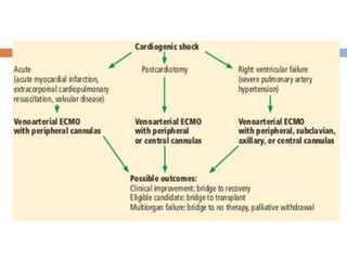 Extracorporeal life support ECLS | PPTX