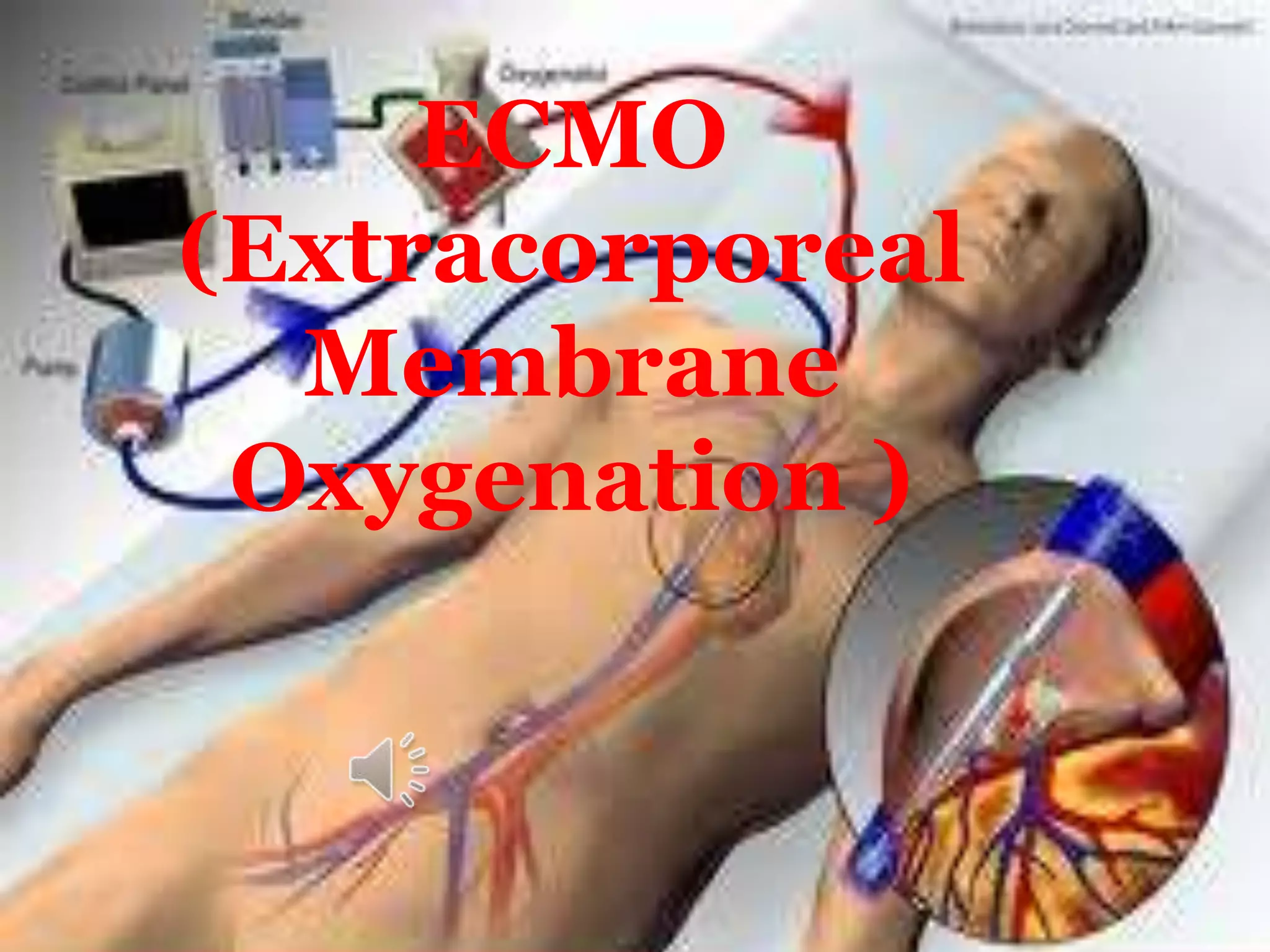 Ecmo | PPTX