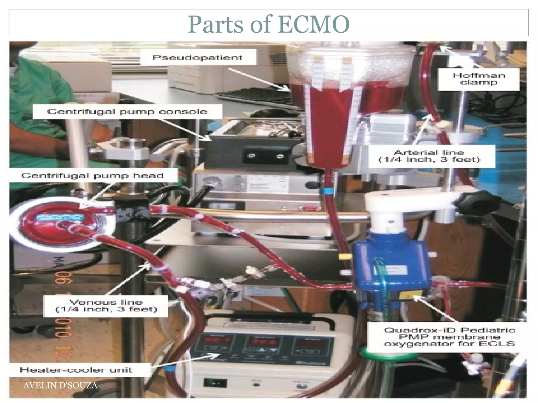 Ecmo | PPT