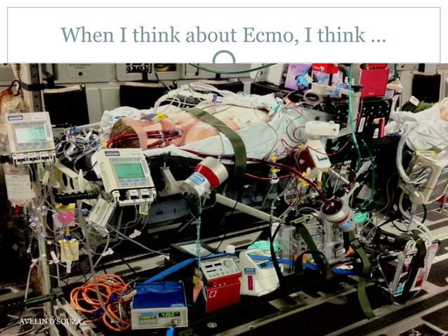Ecmo | PPT