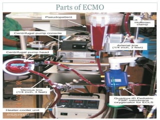 Ecmo Parts