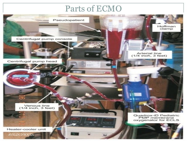 Ecmo