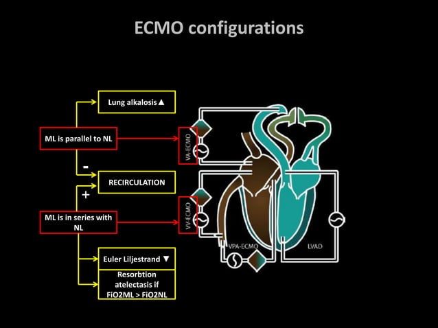 ECMO - beyond protective ventilation | PPTX | Lung and Respiratory Health | Diseases and Conditions