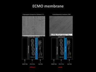 ECMO - beyond protective ventilation | PPTX