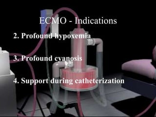 Extracorporeal memebrane oxygenation | PPT