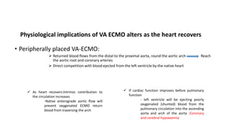 Ecmo | PPTX